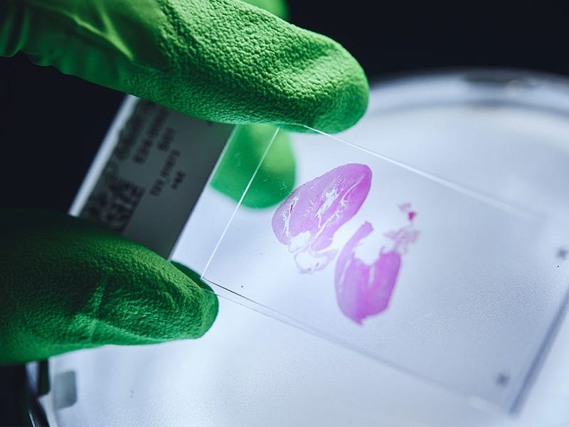 BioNTech's scientific groundwork: Pioneering mRNA research